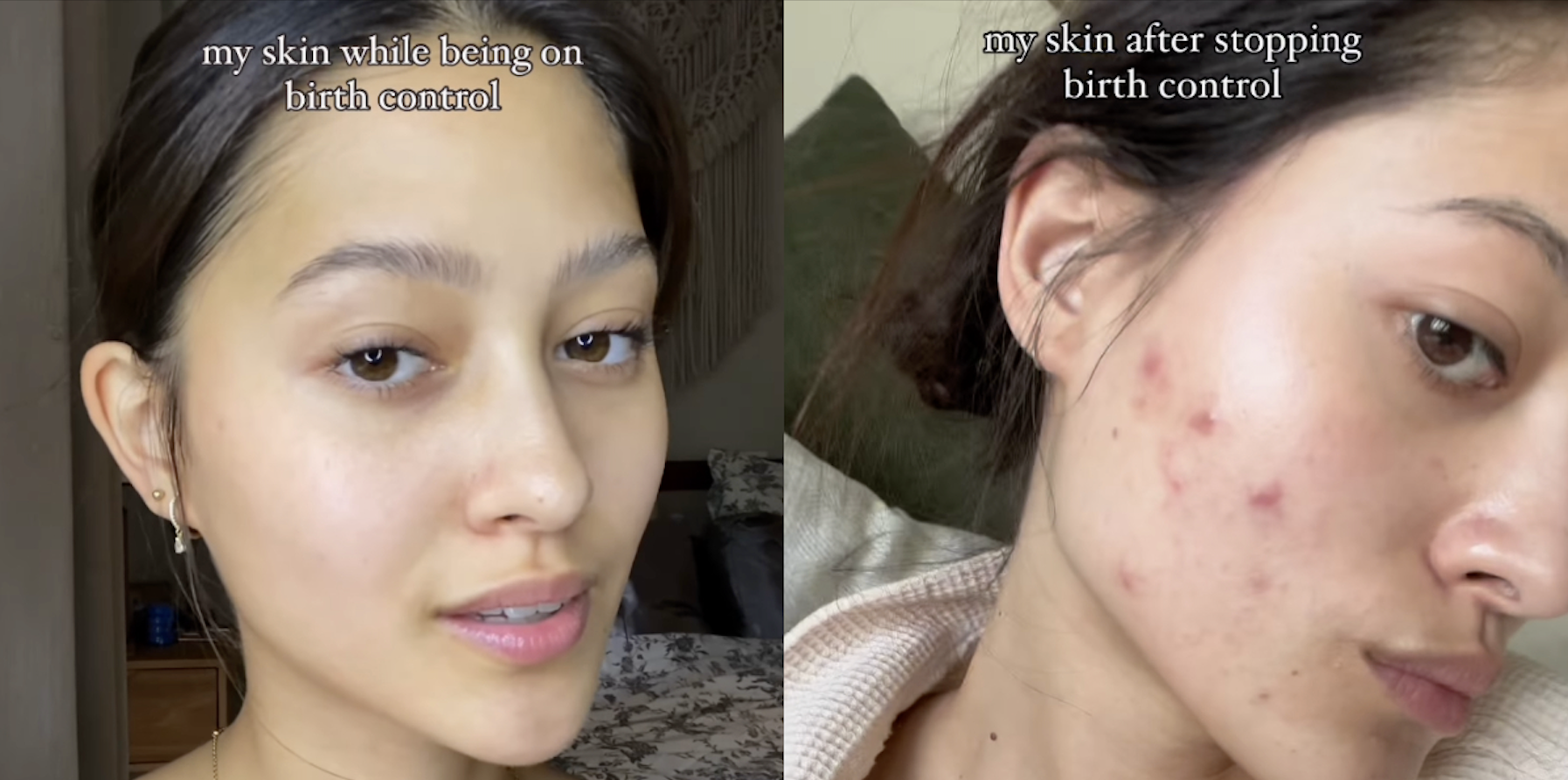 Si Maureen Wroblewitz ay nagpapataas ng kamalayan sa mga side effect ng birth control ...